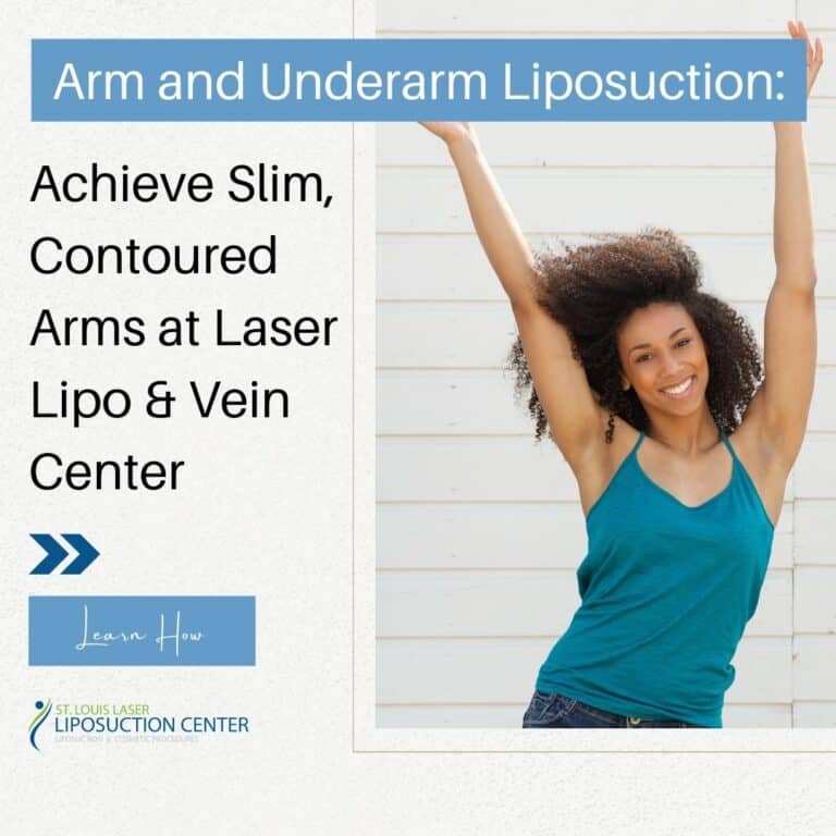 Arm and Underarm Liposuction | St Louis Lipo