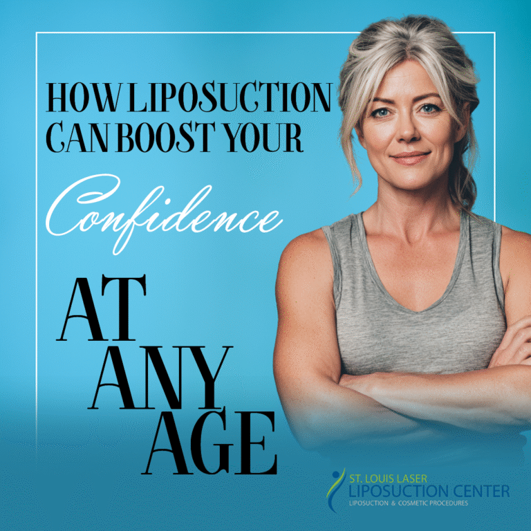 How Liposuction Can Boost Your Confidence at Any Age - St. Louis Laser ...